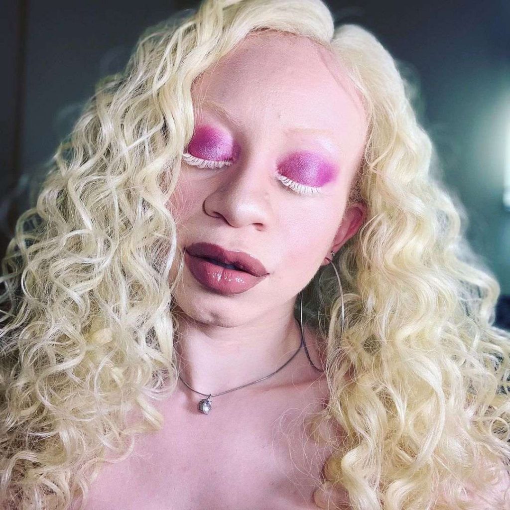 Do Black People With Blonde Hair Exist? (Melanesians, Albinos)